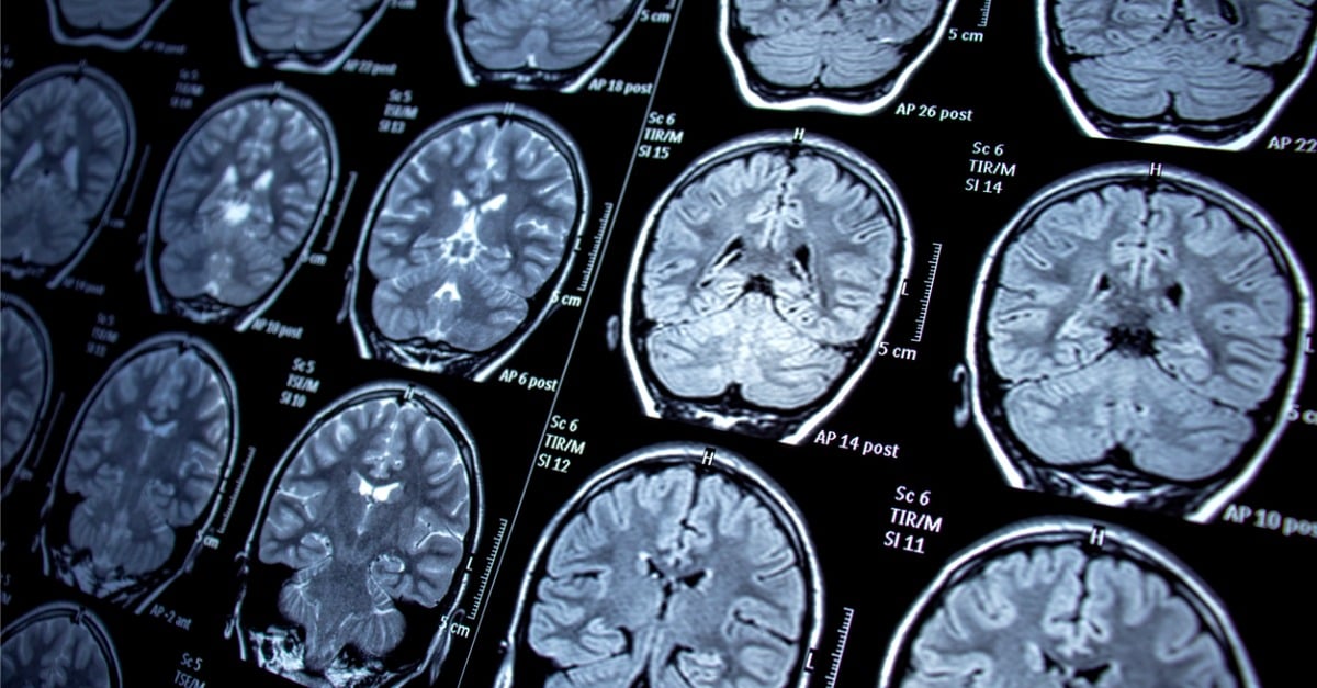 - University Cancer & Blood Center