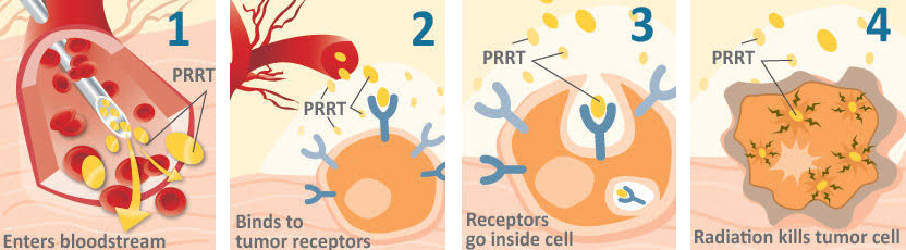 Theranostics - University Cancer & Blood Center